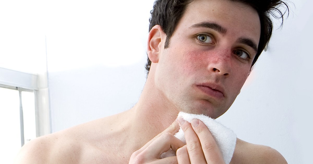 Rosacea an der Nase – Wissenswertes zum Rhinophym
